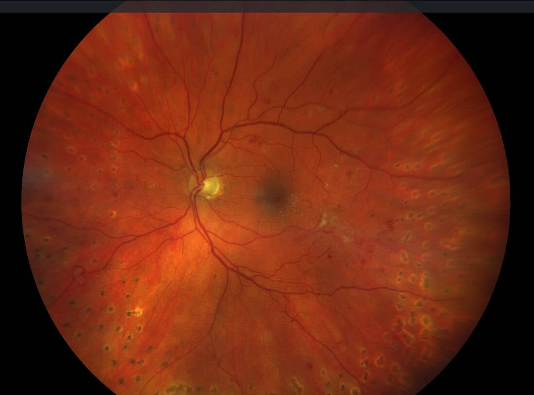 Principles of Diabetic Care - The Journal of Medical Optometry (JoMO)
