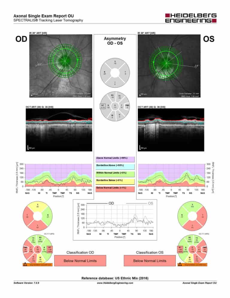 When Retinal Disease Masquerades as Neuro-Ophthalmic Disease - The ...